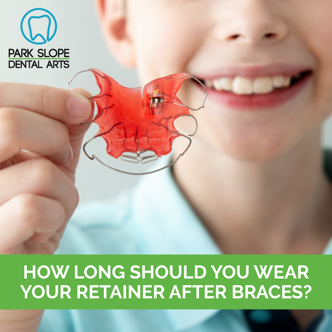 Retainer Wear Time? Brooklyn, NY, Experts Explain | Park Slope Dental Arts